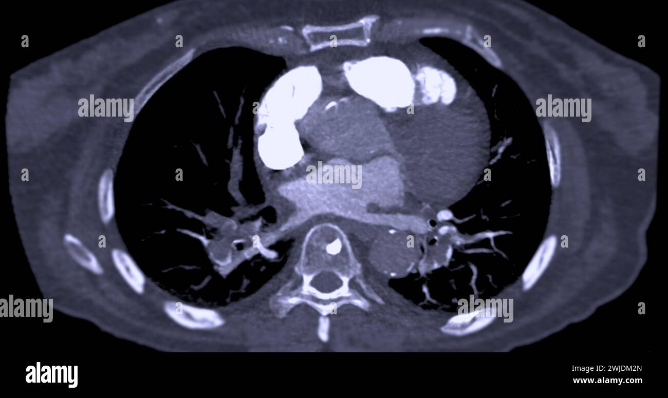 Ventricular connection hi-res stock photography and images - Alamy