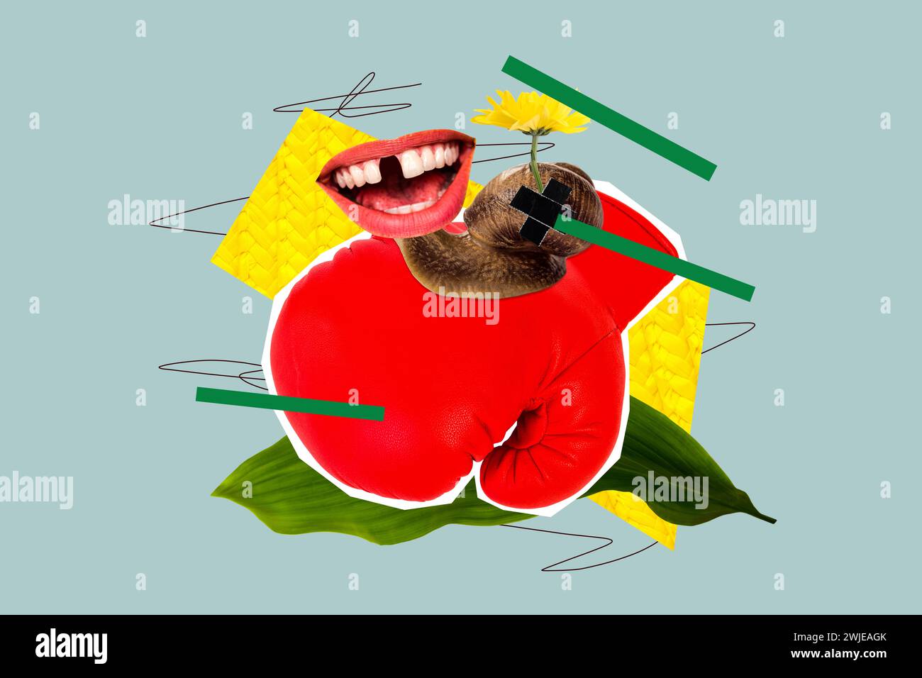 Collage picture poster of human mouth with knocked out tooth after box ...