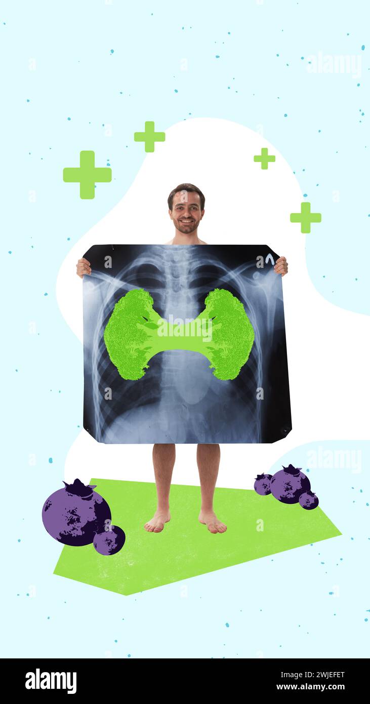 Contemporary art collage. Man holds huge X-ray with fresh, green and ...