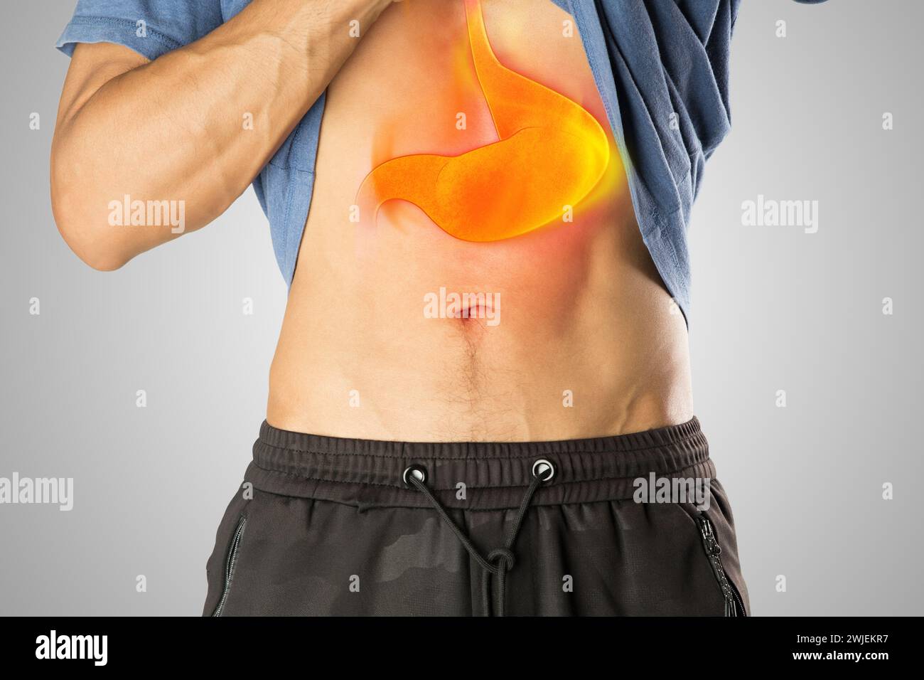 A man has a burning sensation in his chest because he has symptoms of ...