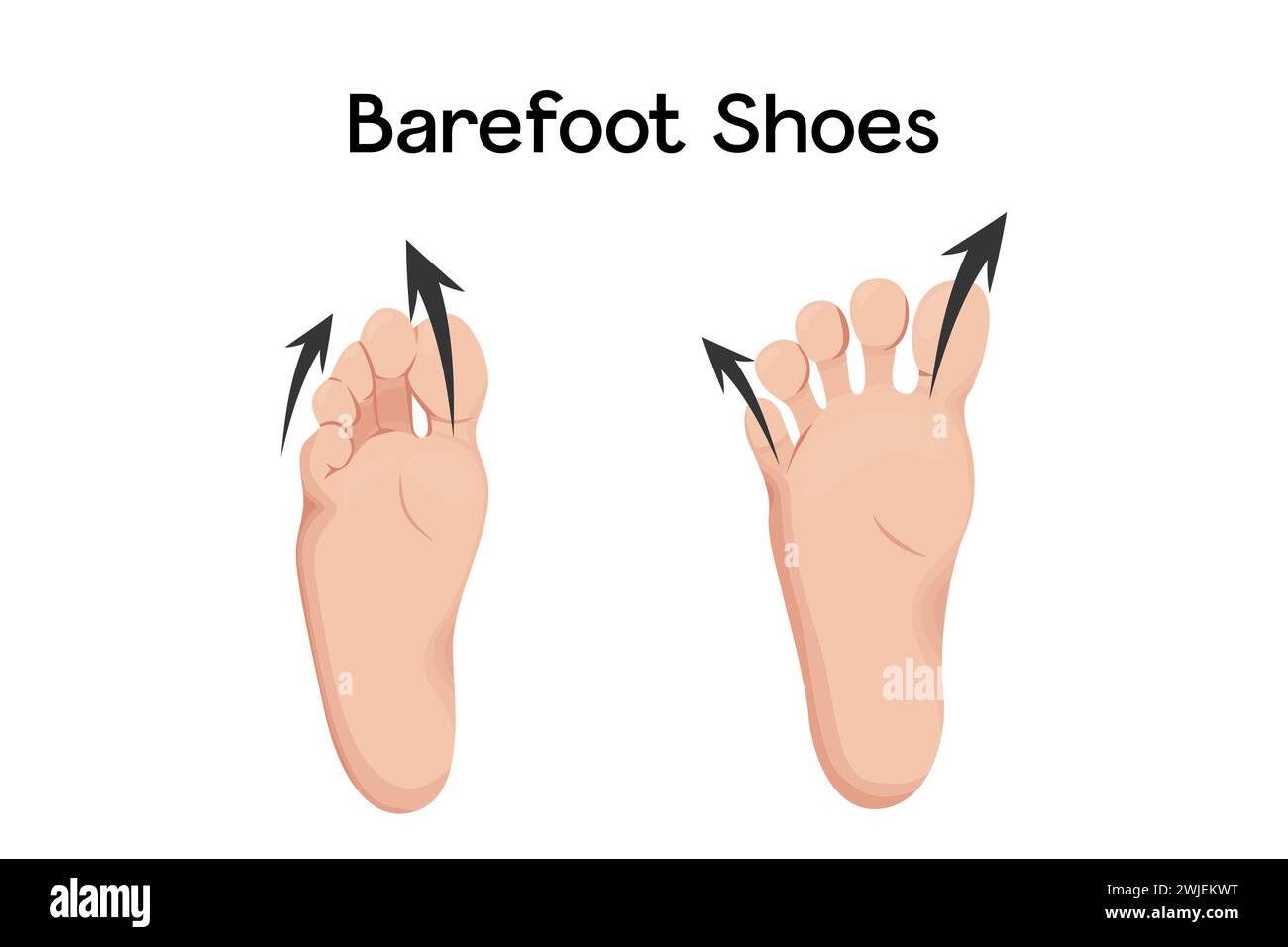 Compare feet before and after barefoot shoes vector illustration Stock ...
