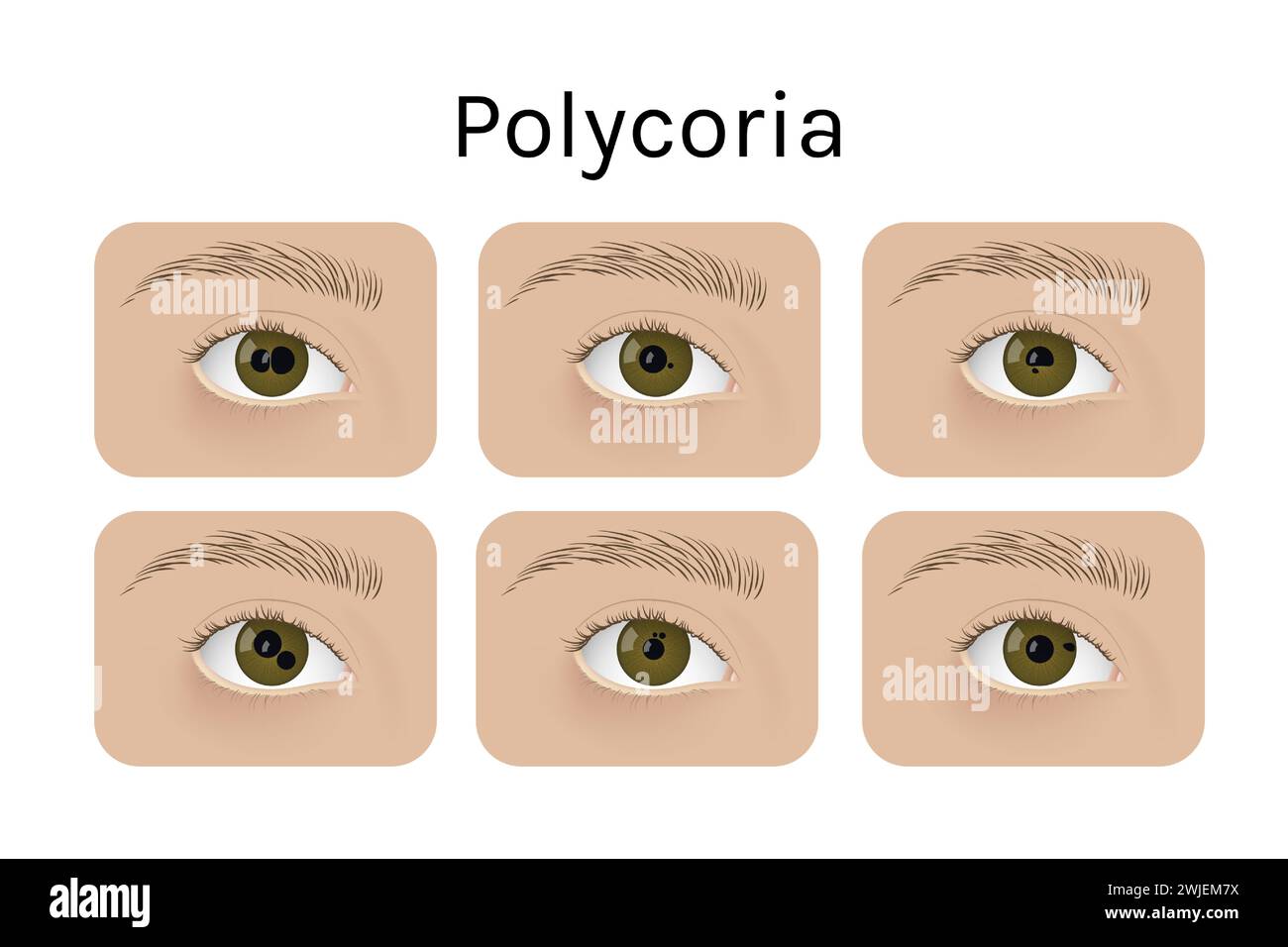 Realistic human eyes with polycoria vector illustration design Stock ...