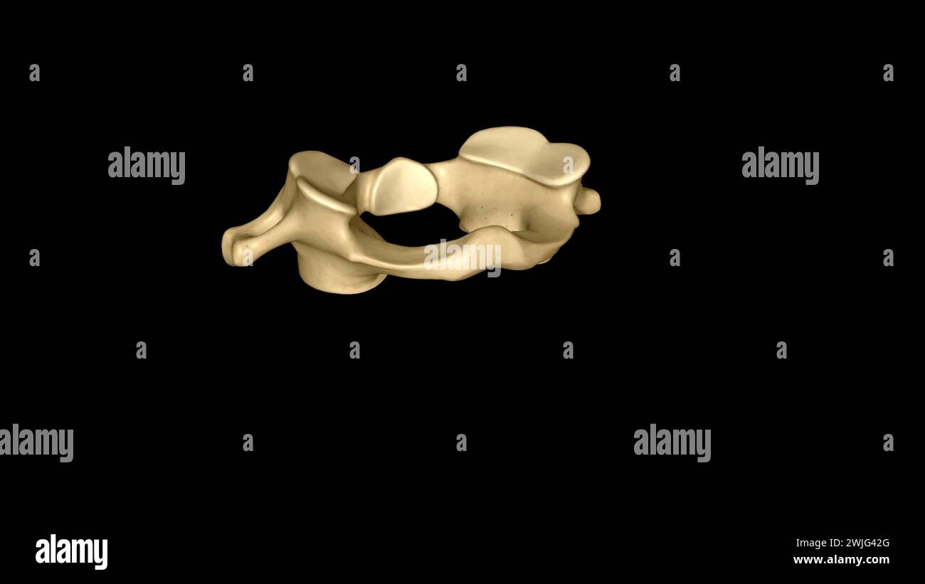 The atlas (plural: atlases) is the first cervical vertebra, commonly ...