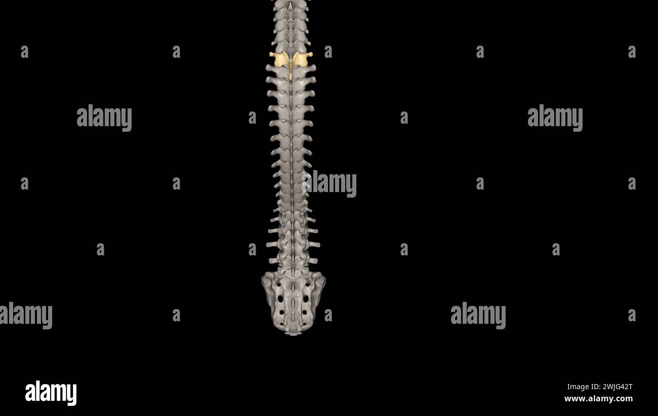 The 7th cervical (C7) vertebra is the largest and most inferior ...