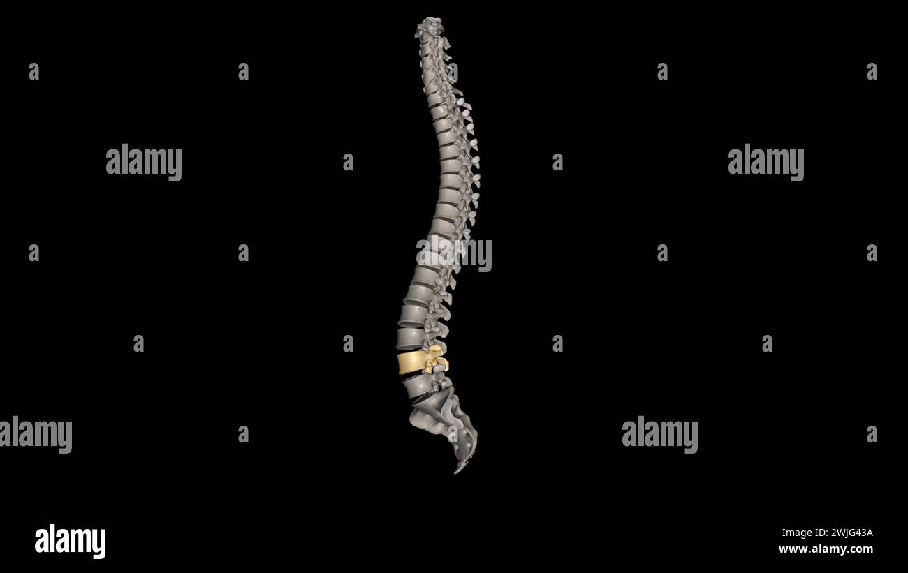The L4 and L5 are the lowest vertebrae, or spinal bones, in the lumbar ...