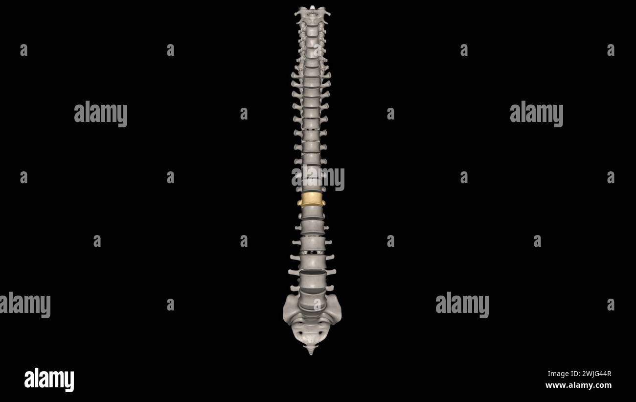 Thoracic Vertebral, T12 Twelve vertebrae are located in the thoracic ...