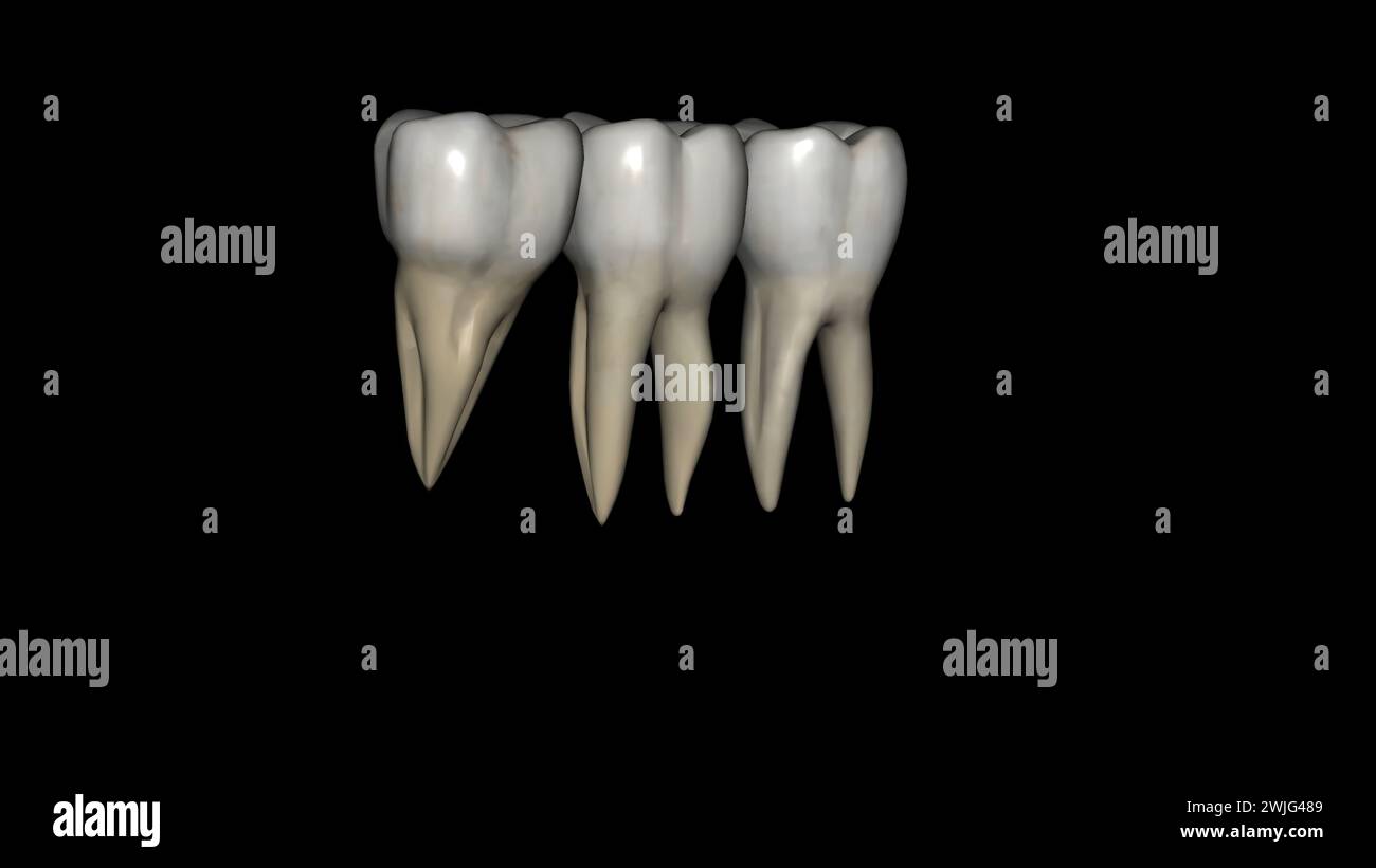 The mandibular first molar usually has two roots, a mesial and a distal ...