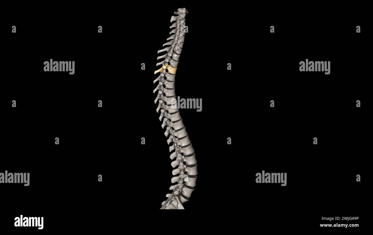Twelve vertebrae are located in the thoracic spine and are numbered T-1 ...