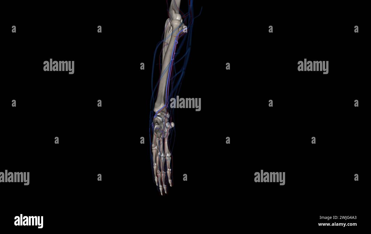 The radial veins originate in the dorsum of the hand from the lateral ...