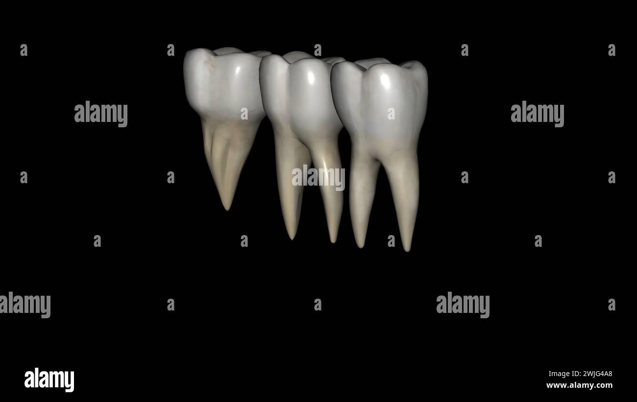 The mandibular first molar usually has two roots, a mesial and a distal ...