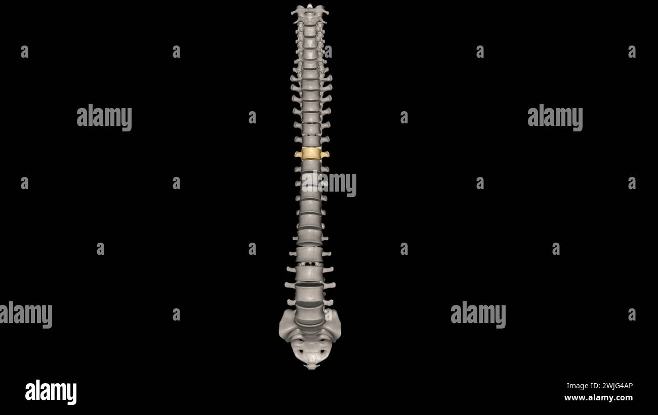 Twelve vertebrae are located in the thoracic spine and are numbered T-1 ...