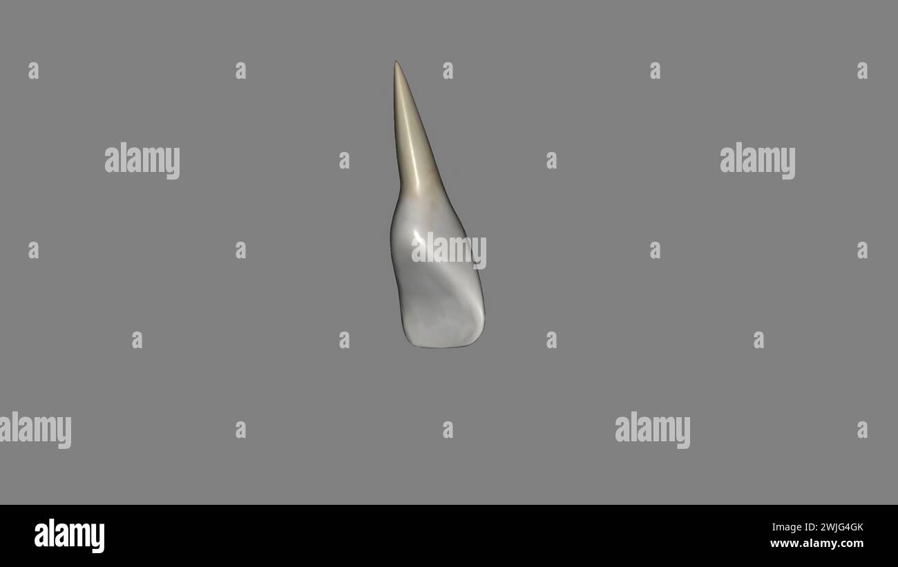 The maxillary lateral incisors are a pair of upper (maxillary) teeth ...