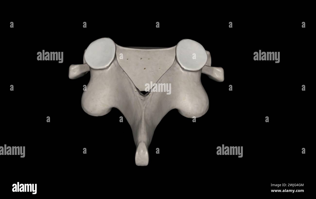 The C6 spinal vertebra is part of the cervical spinal cord, located in ...