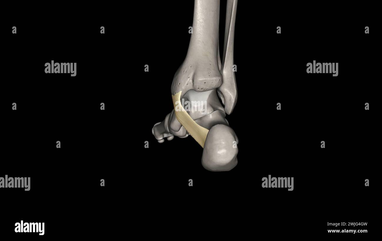 The flexor retinaculum of the foot extends from the medial malleolus ...