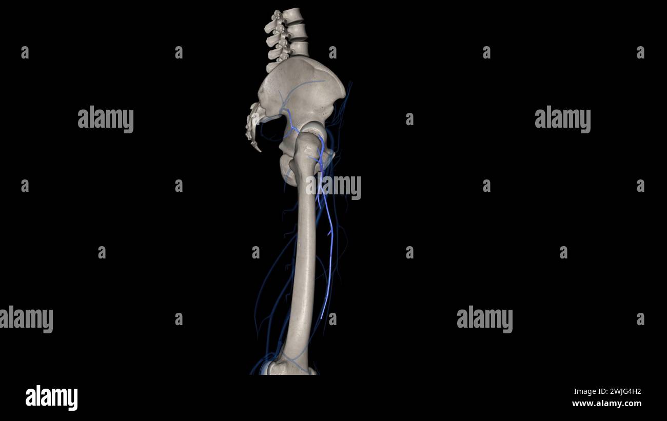 Left femoral artery hi-res stock photography and images - Alamy