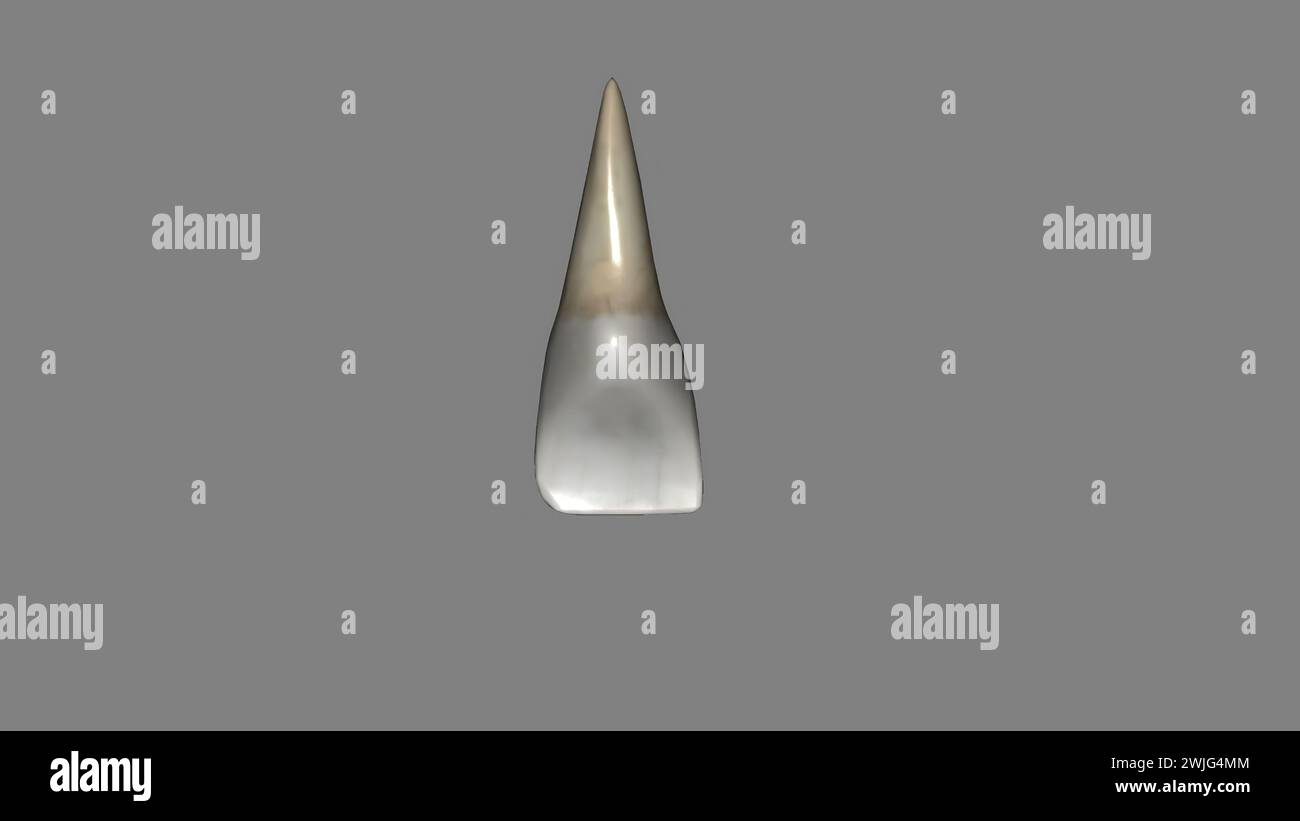 The maxillary central incisors are centered in the maxilla, one on ...