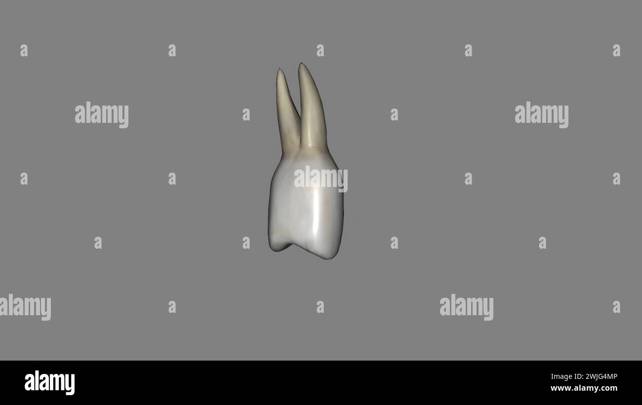 The mandibular first premolar has a bulkier crown compared to the ...
