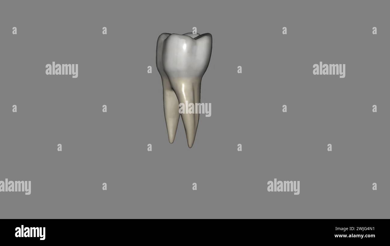 The mandibular first molar usually has two roots, a mesial and a dista ...