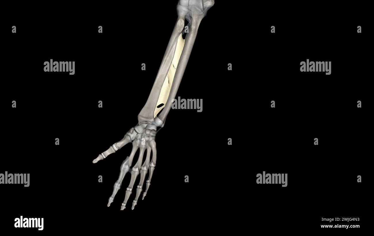 Interosseous membrane of the leg hi-res stock photography and images ...