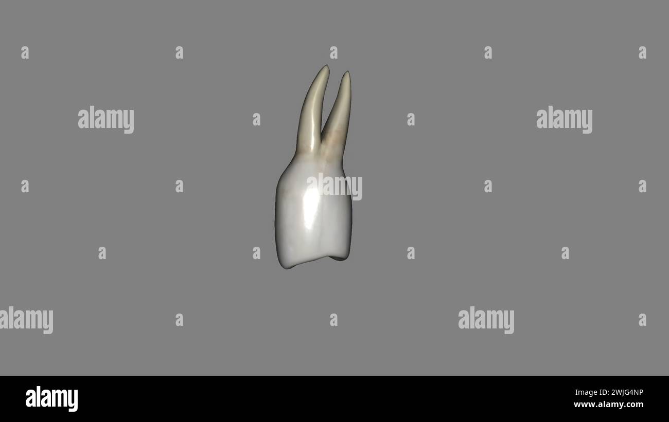 The mandibular first premolar has a bulkier crown compared to the ...