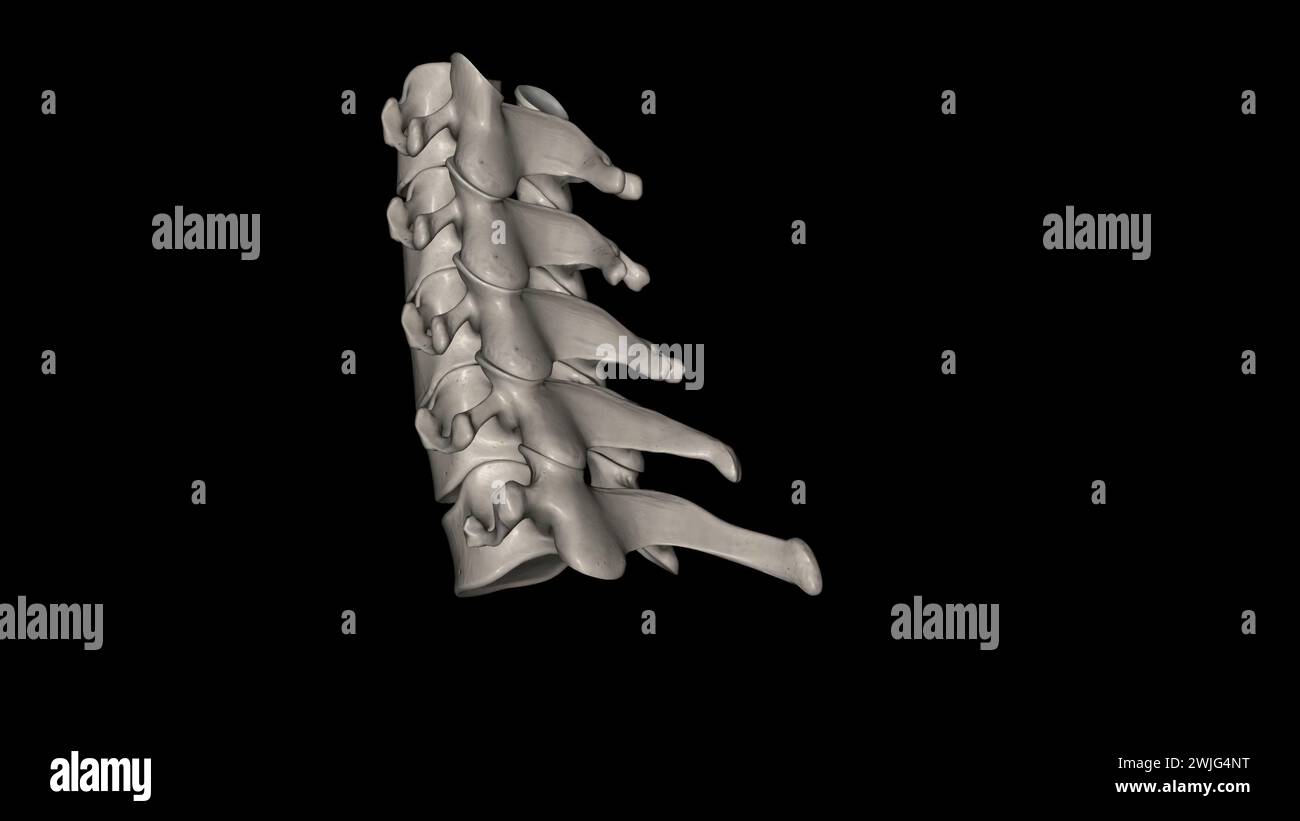 The cervical spine (neck region) consists of seven bones (C1-C7 ...