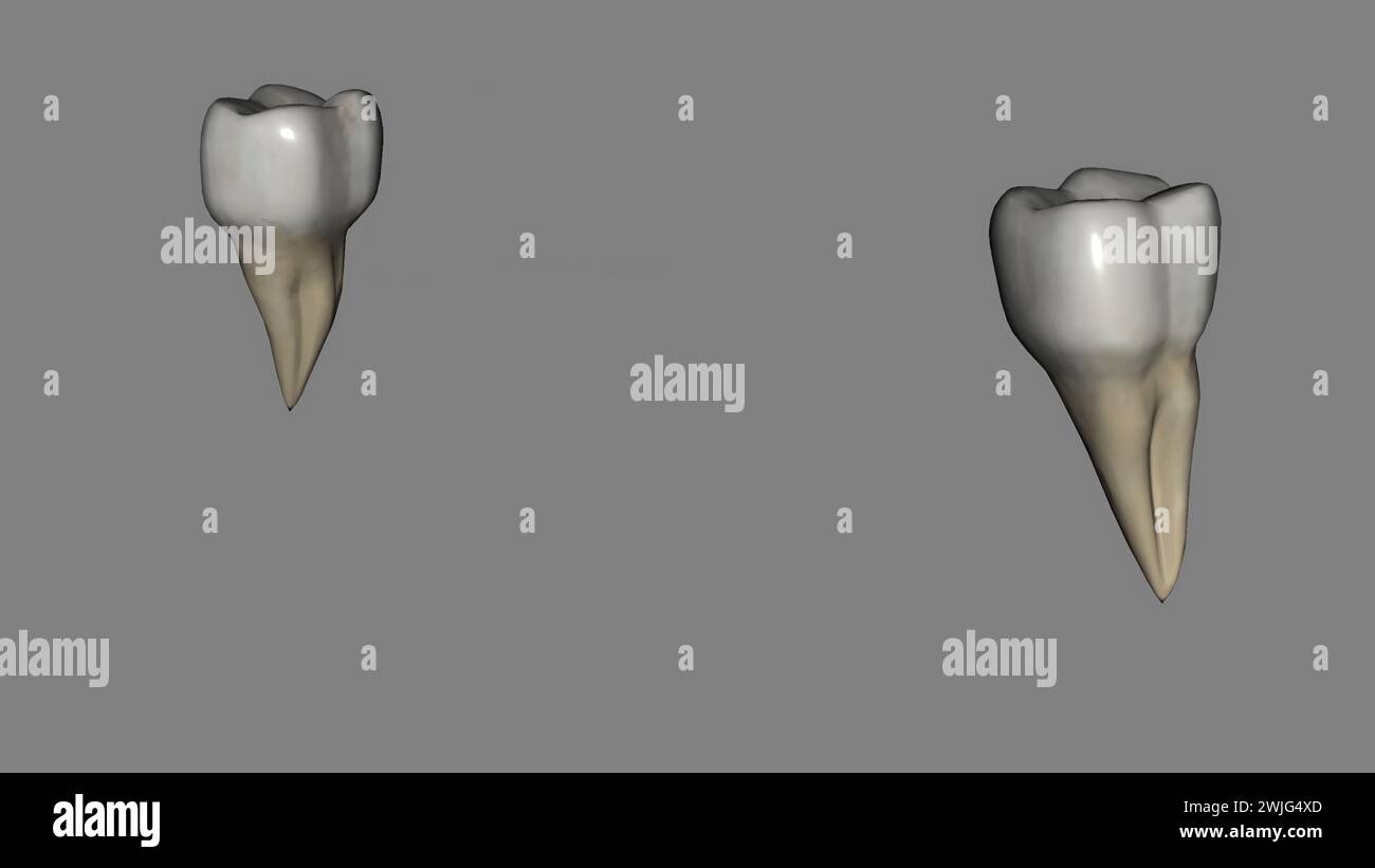The mandibular third molar is also referred as the wisdom tooth 3d ...
