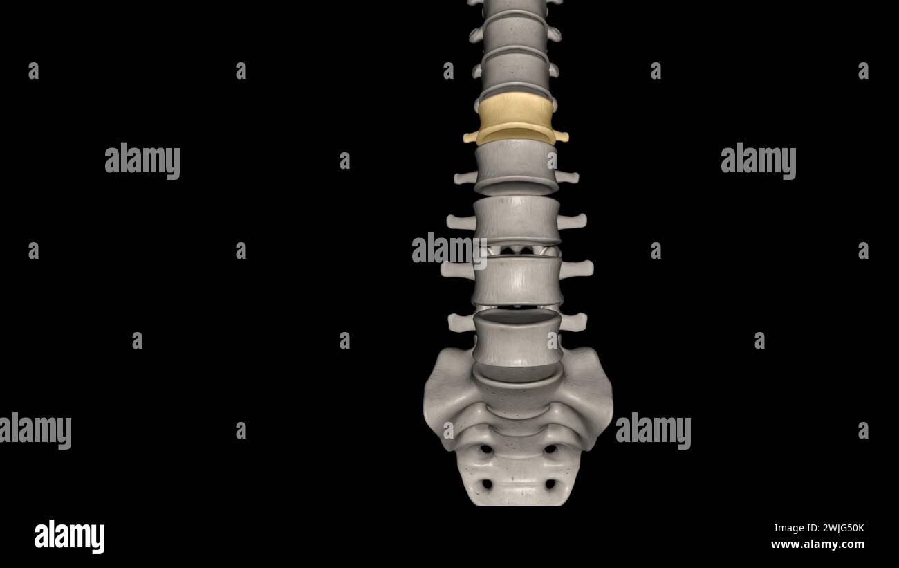 The lumbar region of the spine, more commonly known as the lower back ...