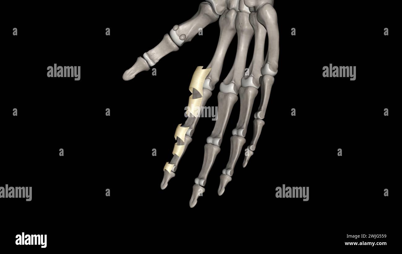 The Annular Ligament Is A Complex Structure Formed From The Capsule Lateral Collateral