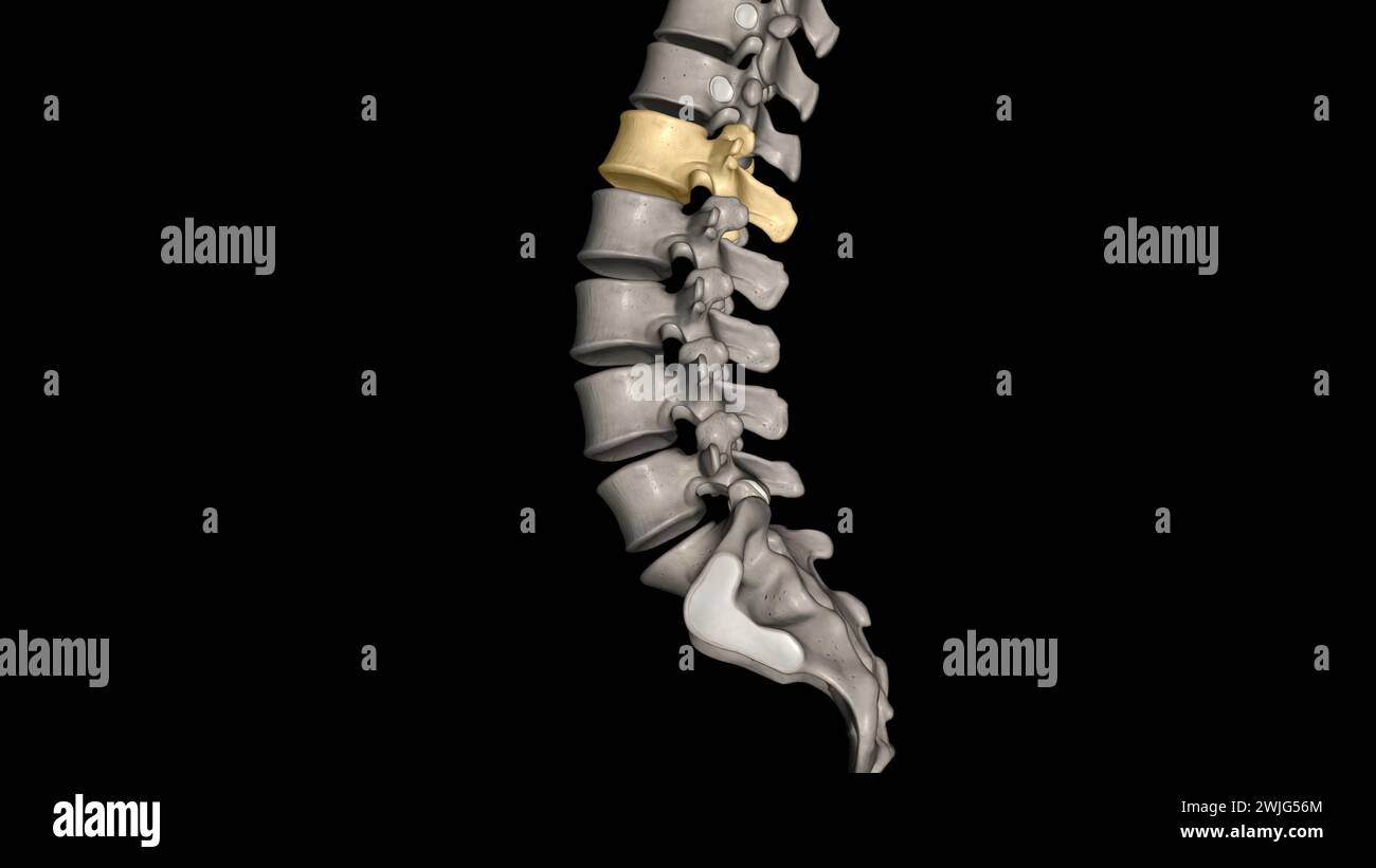 Labeled skull hi-res stock photography and images - Alamy