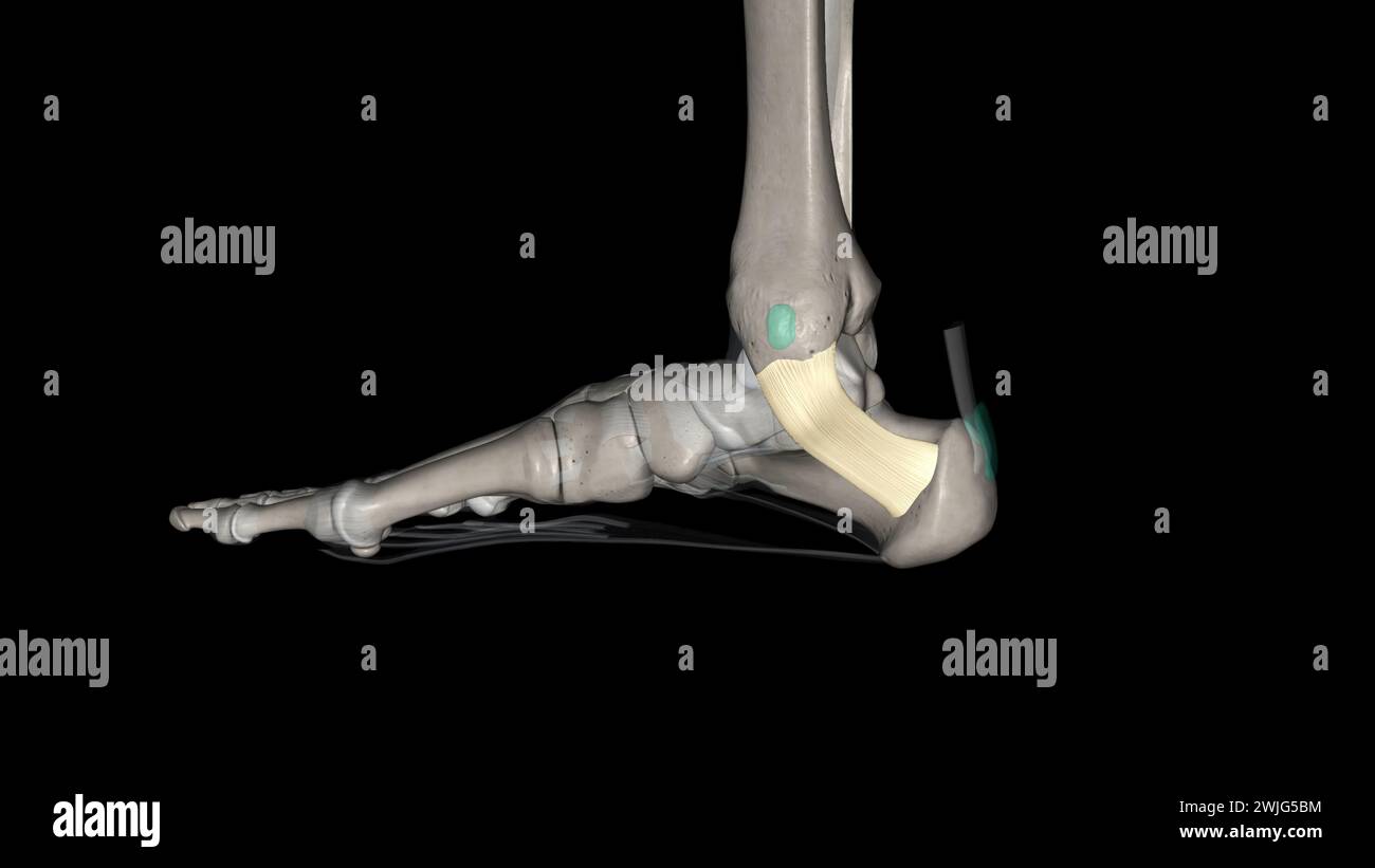 The flexor retinaculum of the foot extends from the medial malleolus ...