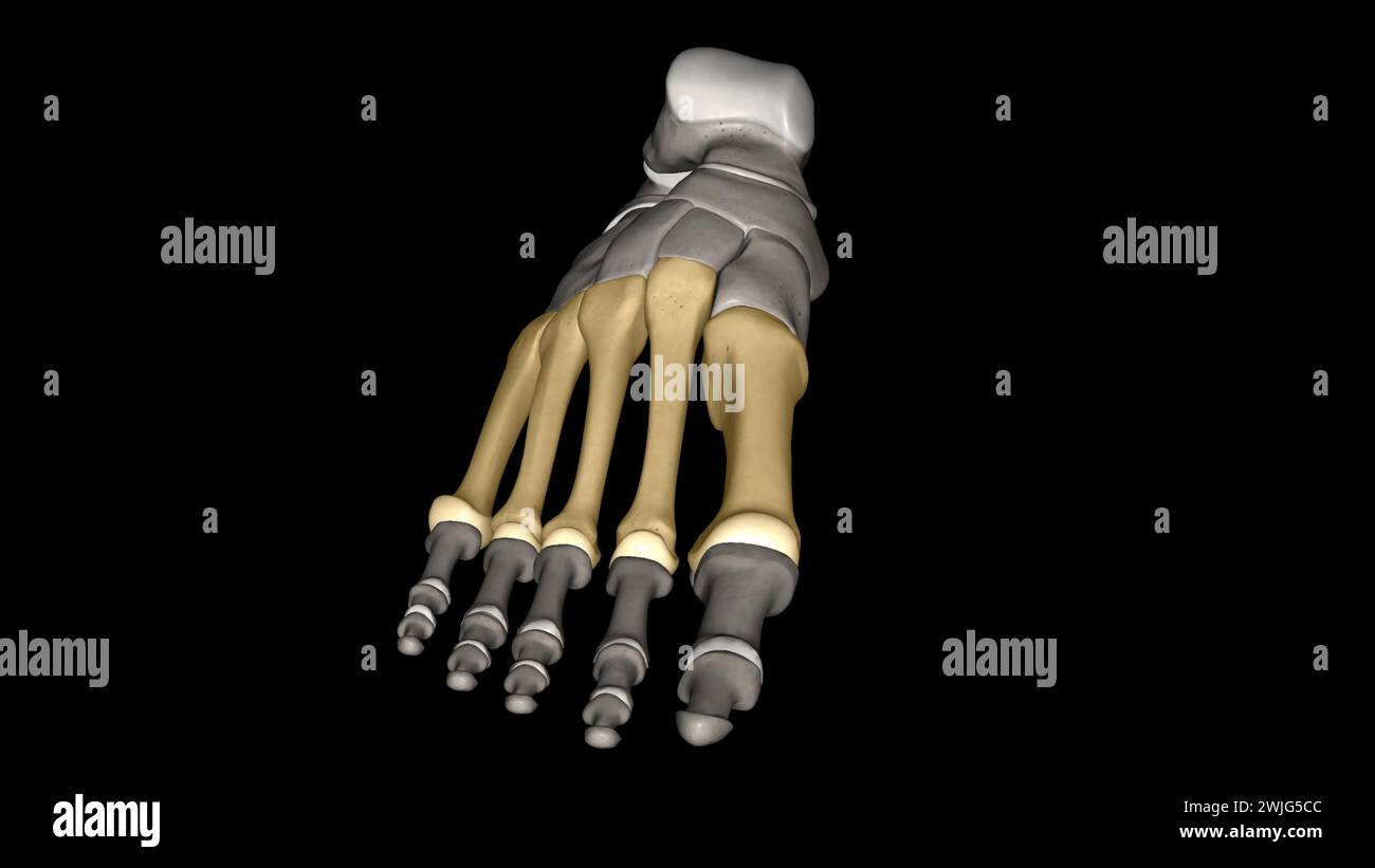 The metatarsal bones are the bones of the forefoot that connect the ...