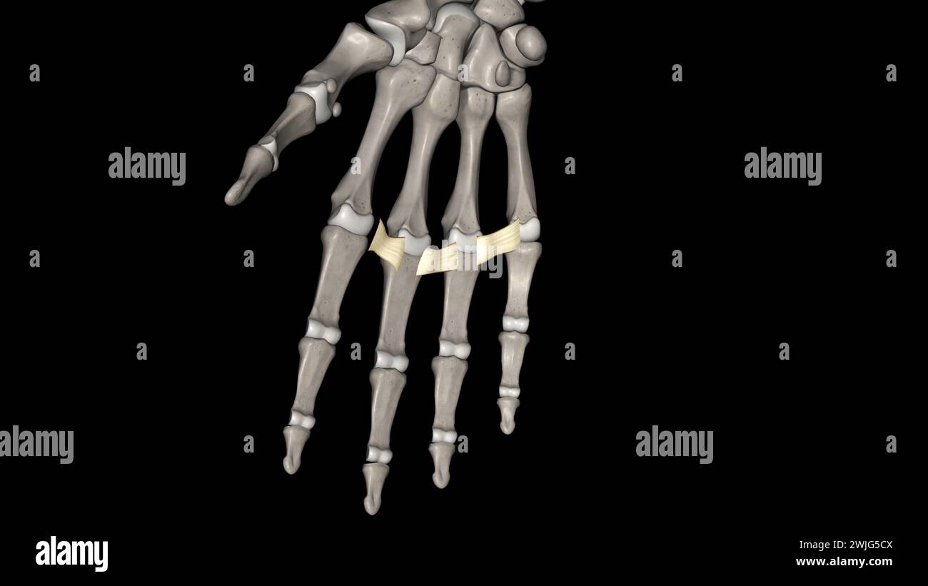 Metacarpophalangeal Joint Ligaments The Transverse Metacarpal