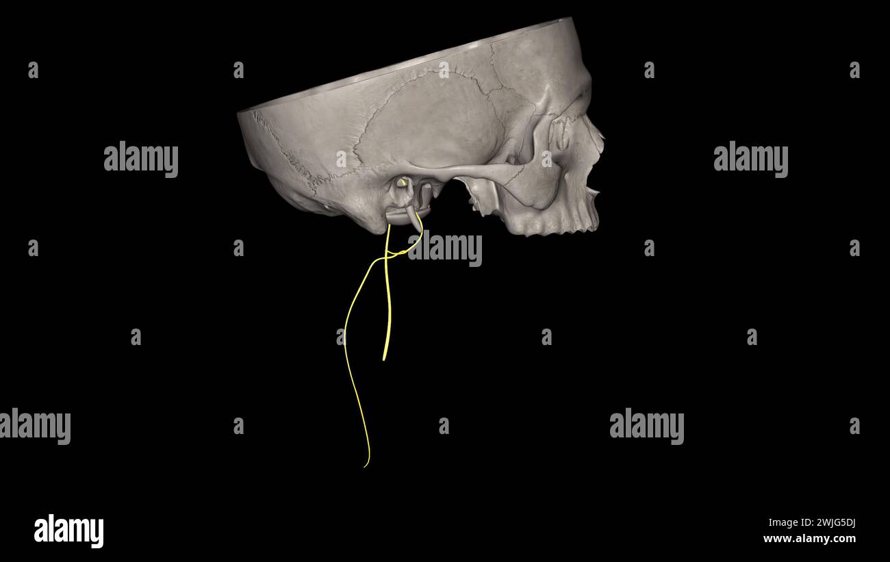 The spinal accessory nerve is a purely motor entity. It innervates both ...