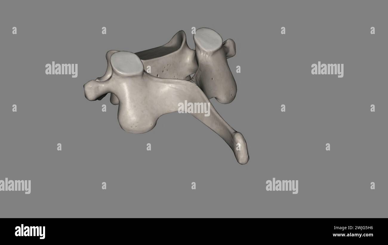 The 7th cervical (C7) vertebra is the largest and most inferior ...