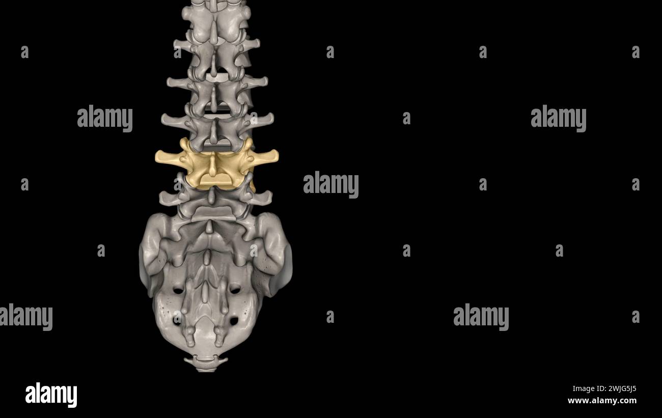 The L4 and L5 are the lowest vertebrae, or spinal bones, in the lumbar ...