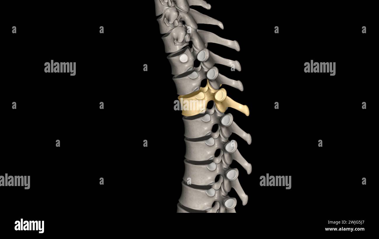 Thoracic spine vertebrae fracture hi-res stock photography and images ...