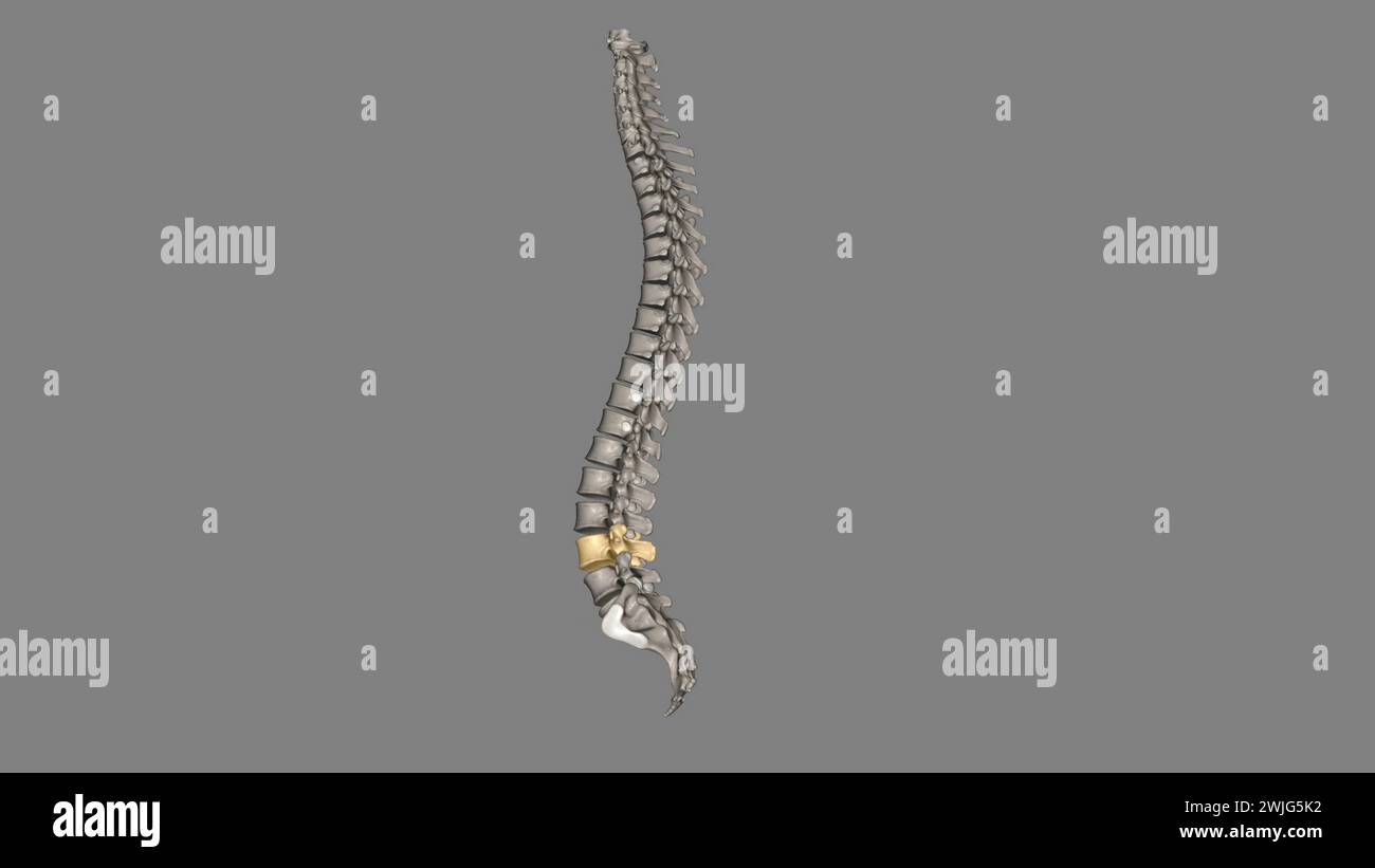 The L4 and L5 are the lowest vertebrae, or spinal bones, in the lumbar ...