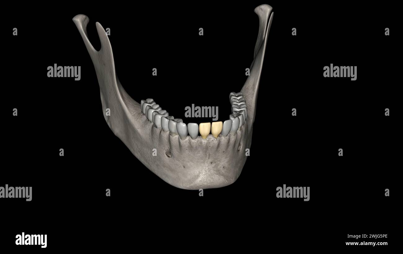 The mandibular central incisor is the tooth located on the jaw ...