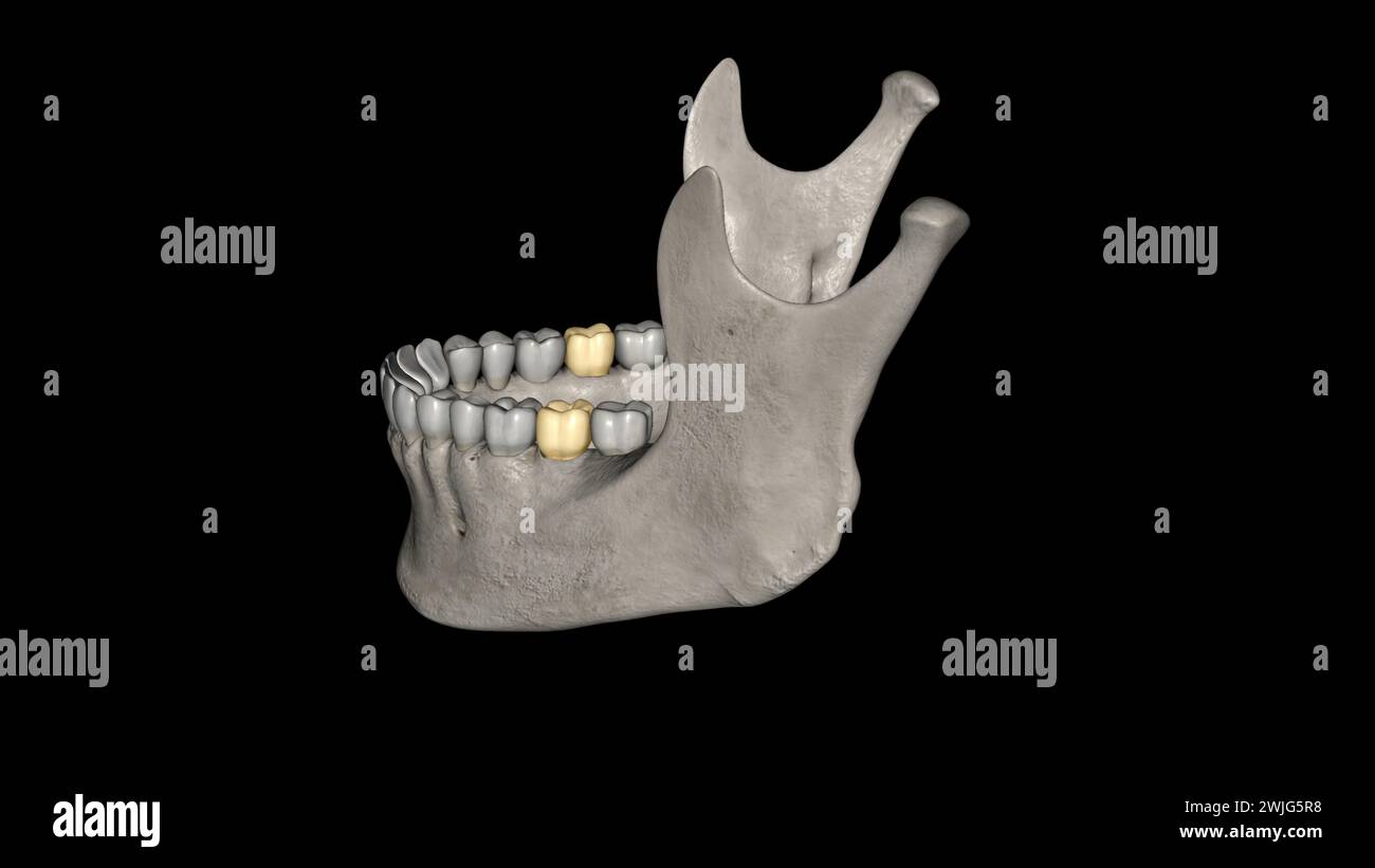 Mandibular second molar hi-res stock photography and images - Alamy