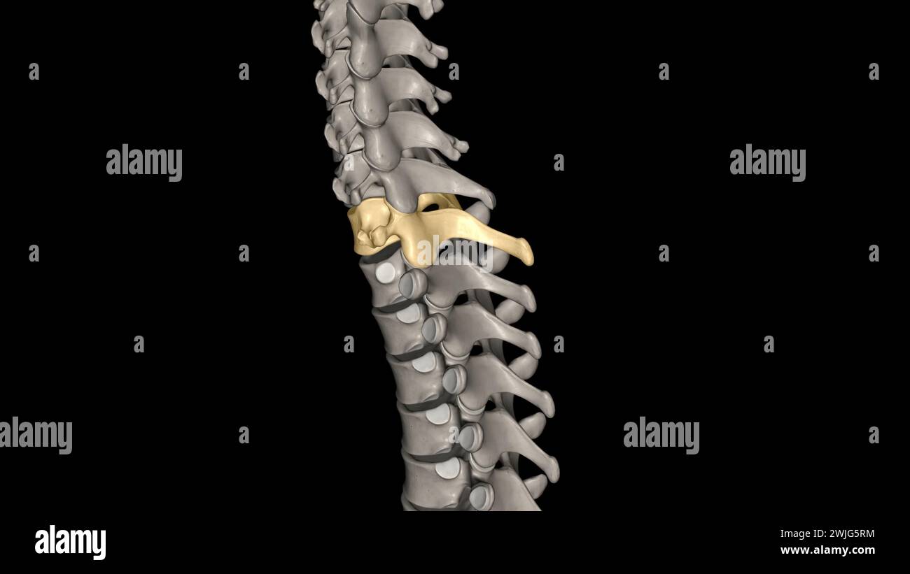 The 7th cervical (C7) vertebra is the largest and most inferior ...