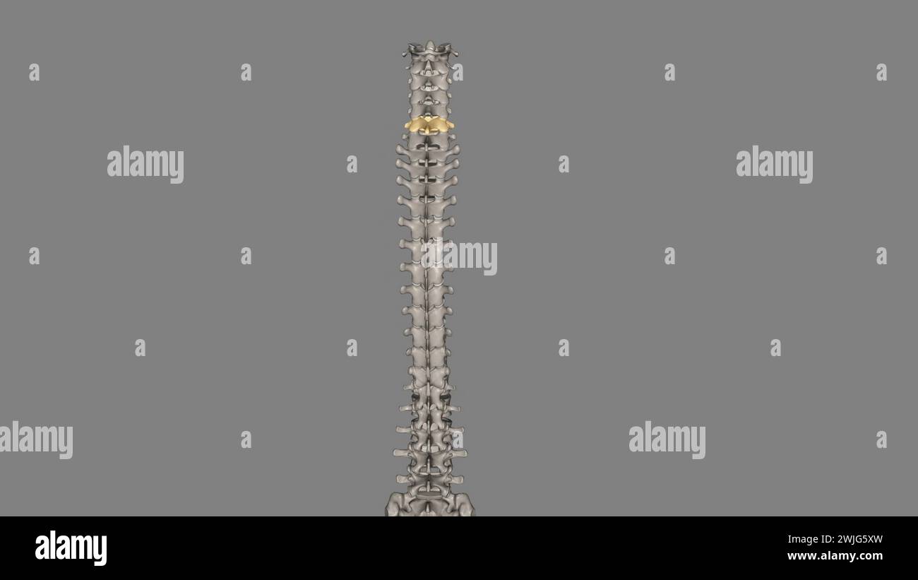 The C6 spinal vertebra is part of the cervical spinal cord, located in ...