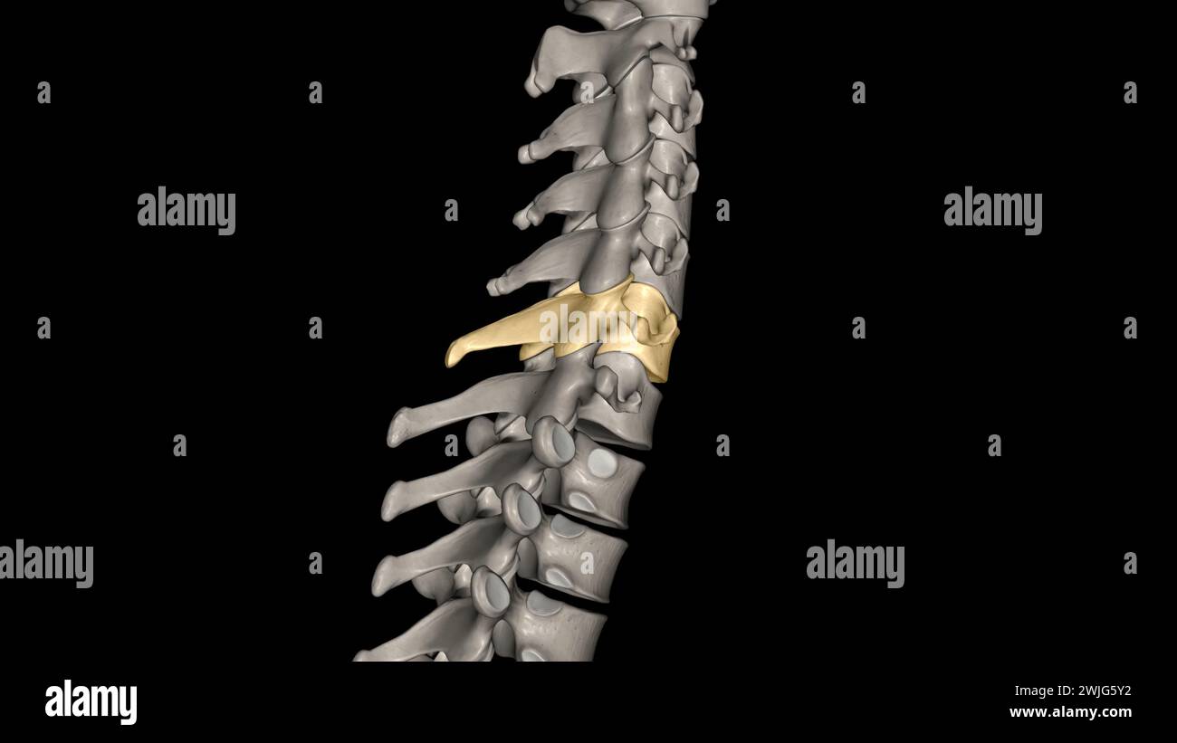 The C6 spinal vertebra is part of the cervical spinal cord, located in ...