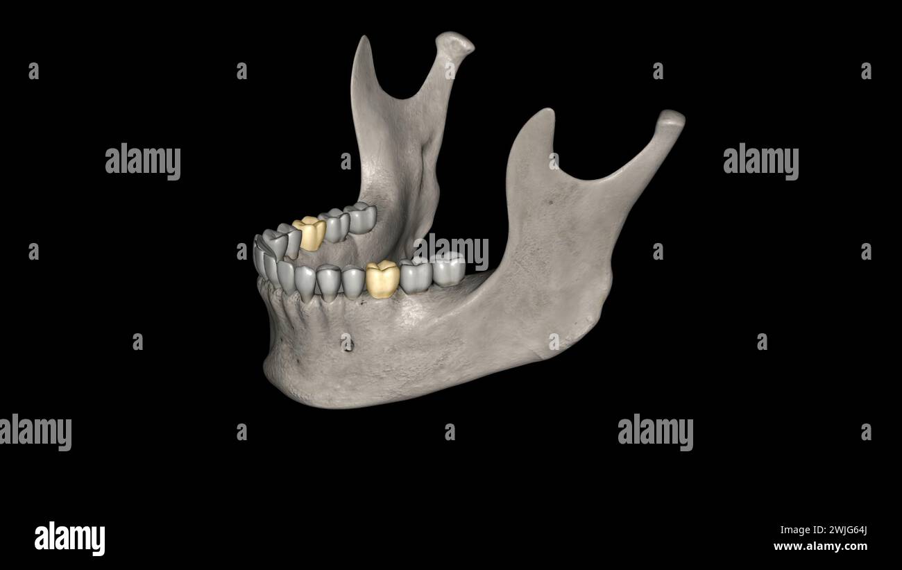 Mandibular first molar hi-res stock photography and images - Alamy