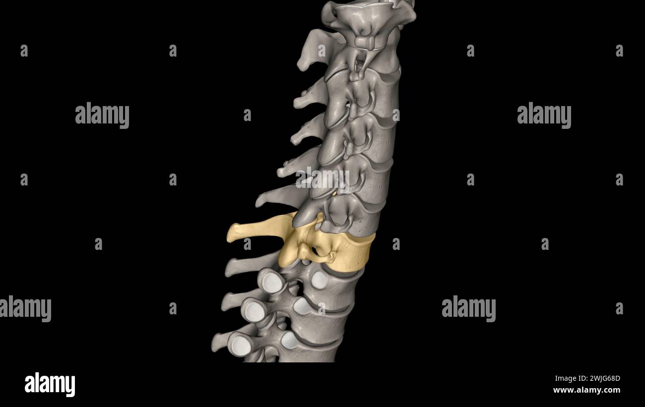 The 7th cervical (C7) vertebra is the largest and most inferior ...