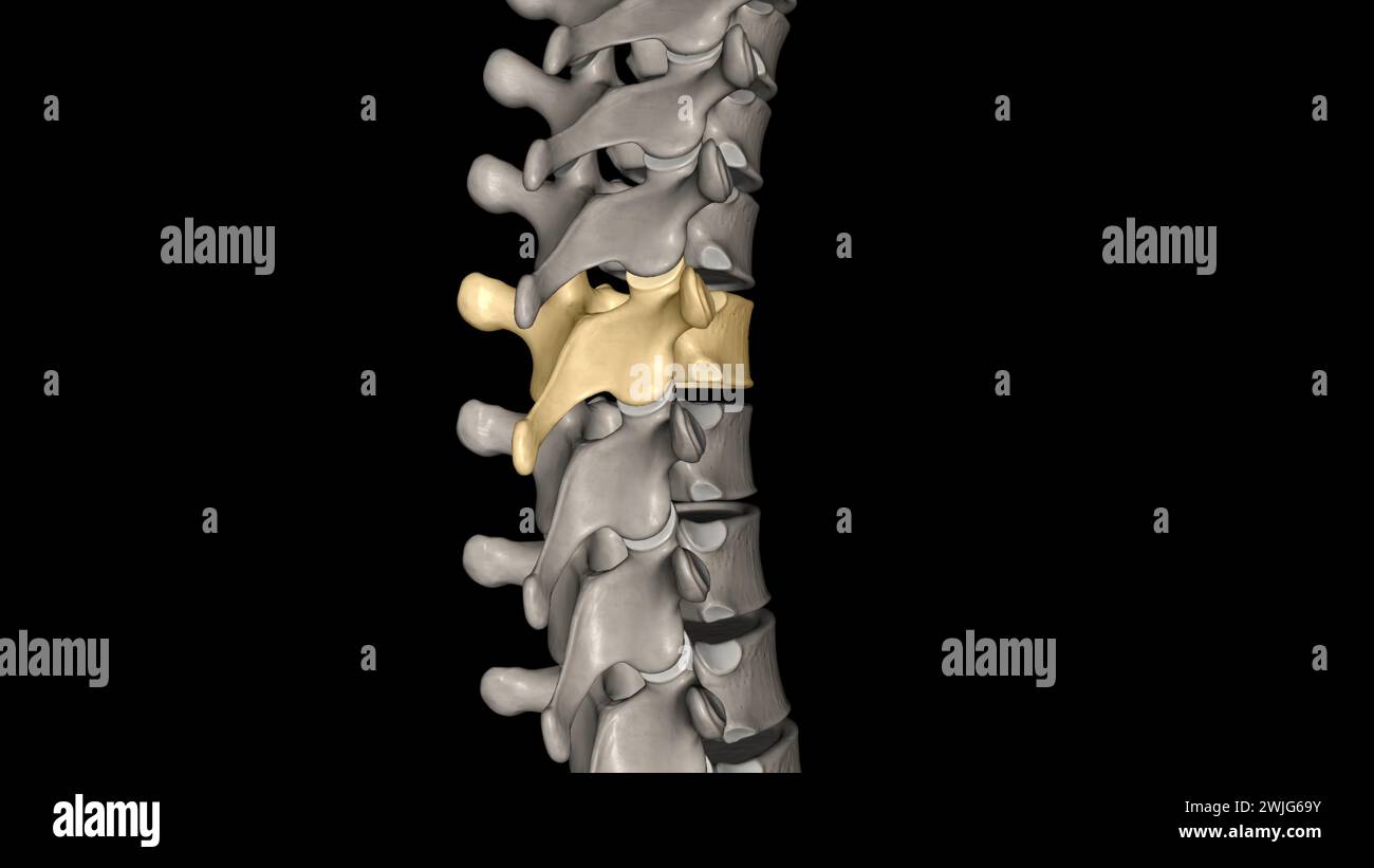 Thoracic Vertebral, T5 Twelve vertebrae are located in the thoracic ...