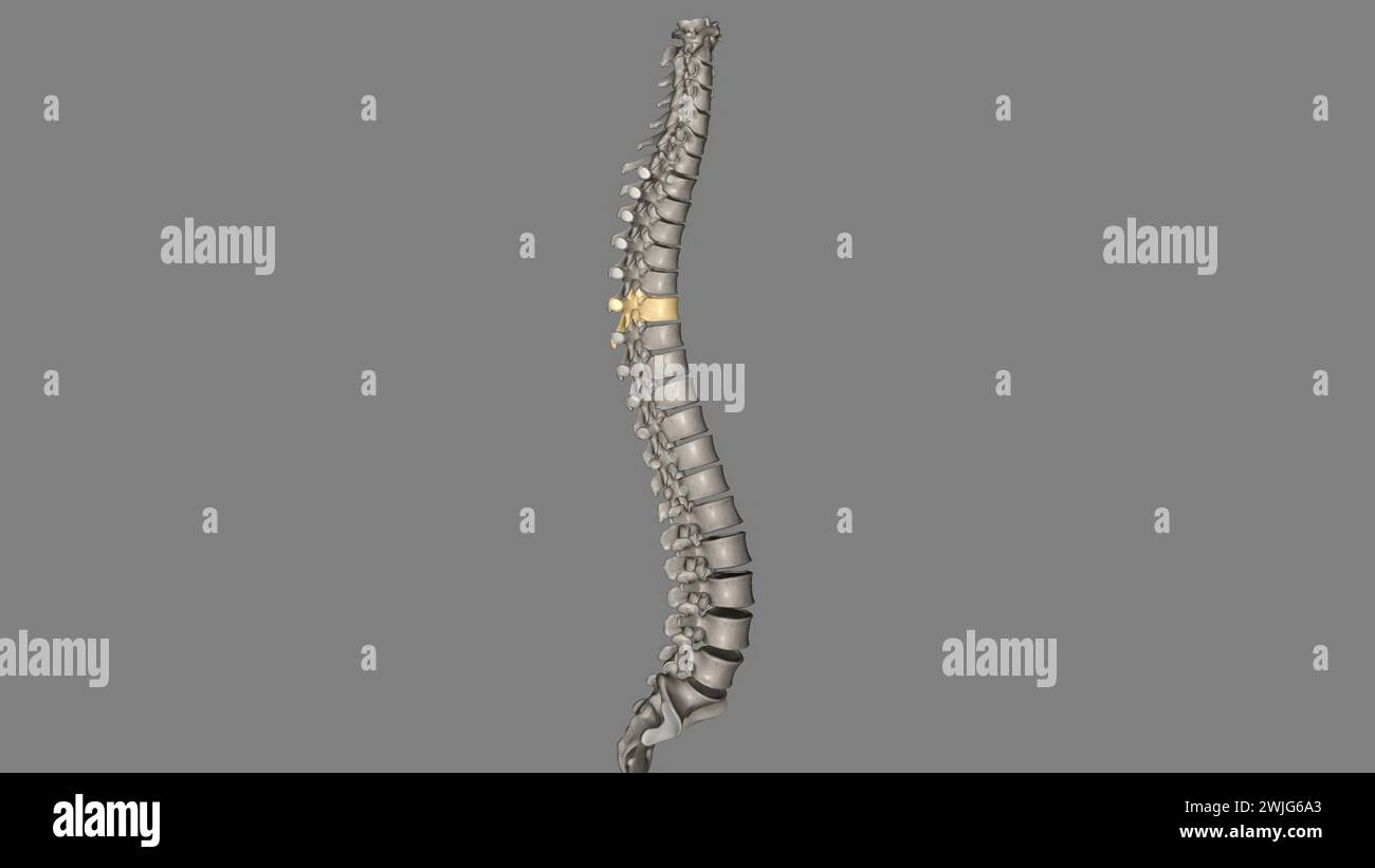 Twelve vertebrae are located in the thoracic spine and are numbered T-1 ...