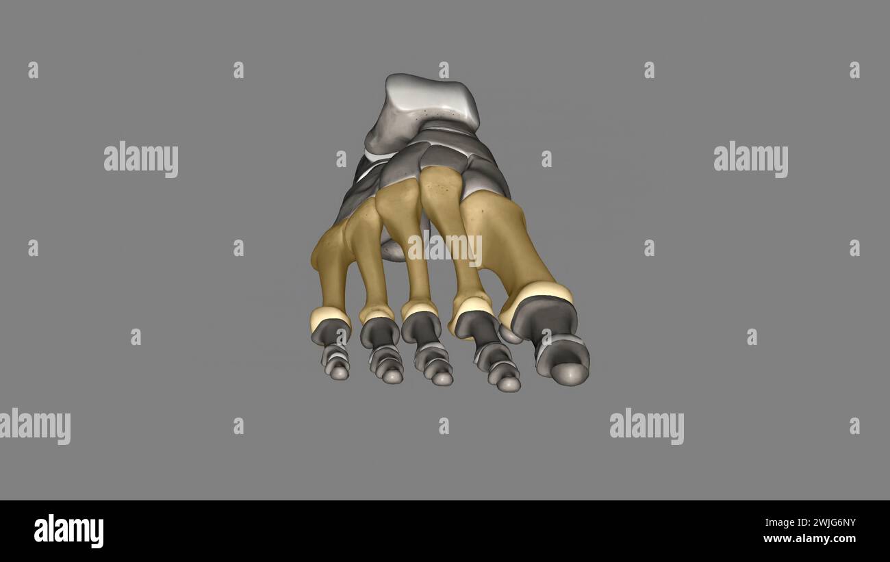 The metatarsal bones are the bones of the forefoot that connect the ...