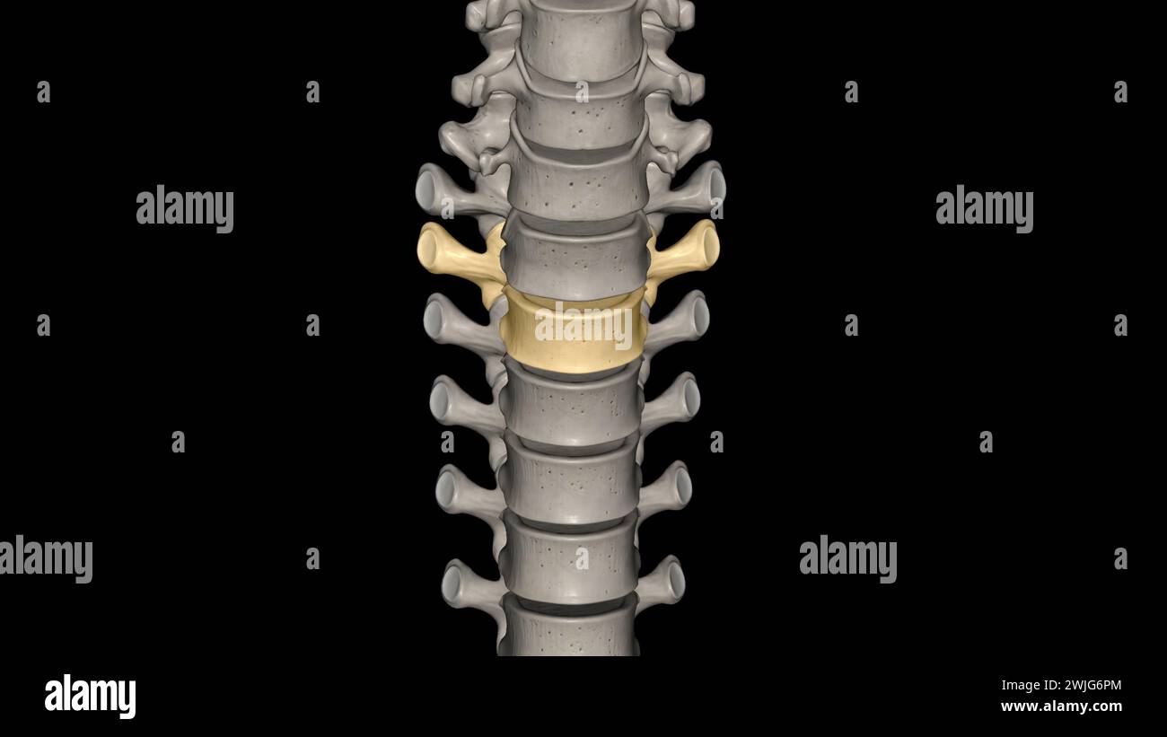 Thoracic spine vertebrae fracture hi-res stock photography and images ...