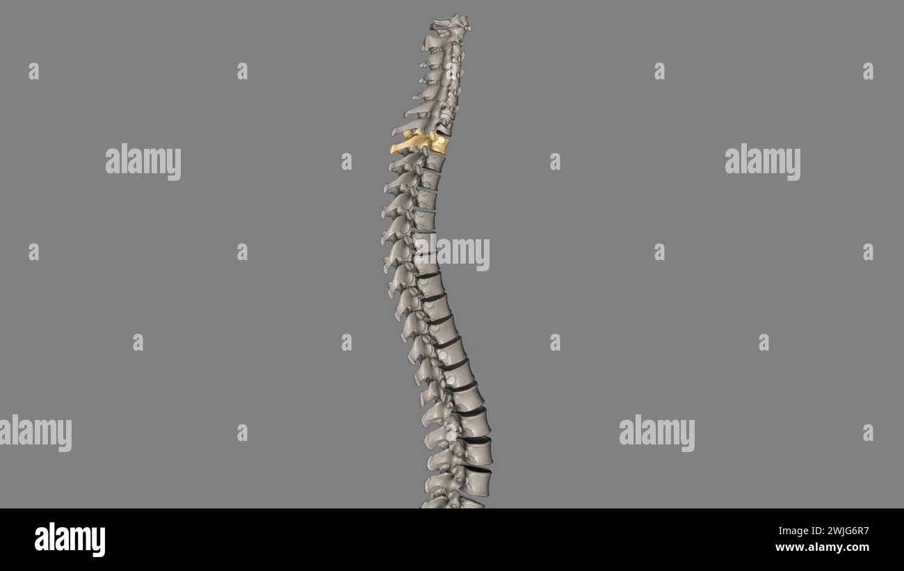 The L4 and L5 are the lowest vertebrae, or spinal bones, in the lumbar ...