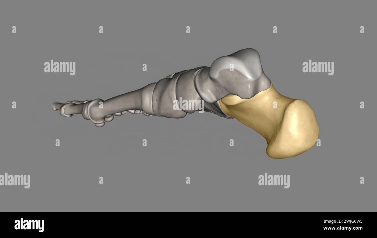 The calcaneus (heel bone) is the largest of the tarsal bones in the ...